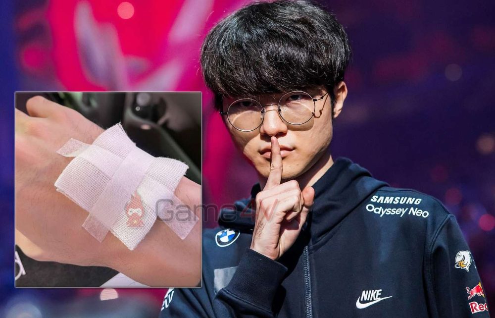 Faker bị thương ở tay, fan đùa rằng Quỷ Vương có ‘bảo hiểm 1 tỷ Won ...